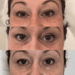 Skinbooster – Benefícios, Preços e Antes e Depois【2026】